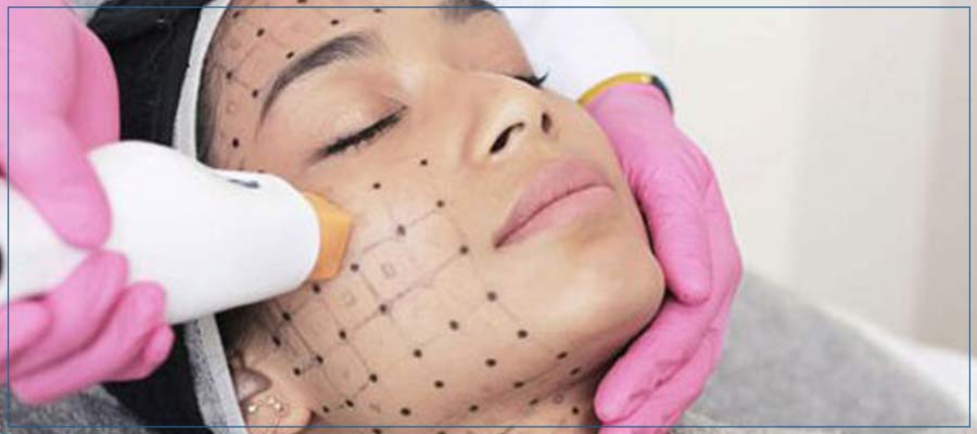 The Ultimate Guide to Thermage in Koreatown: What to Expect - Shiny ...